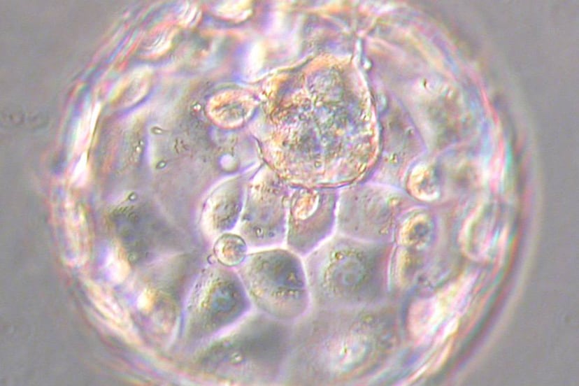 ‘Zwengel nu het debat aan over zaadcellen en eicellen uit het lab’ | Trouw