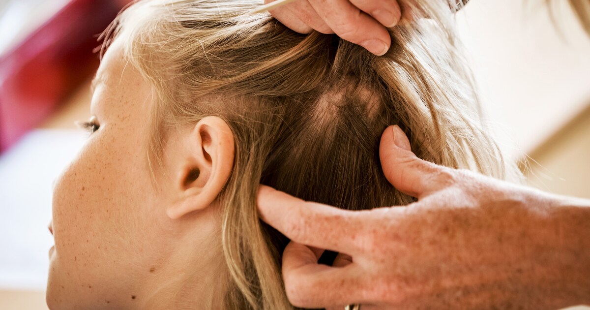 De hoofdluis brengt de menselijke migratie goed in beeld | Trouw