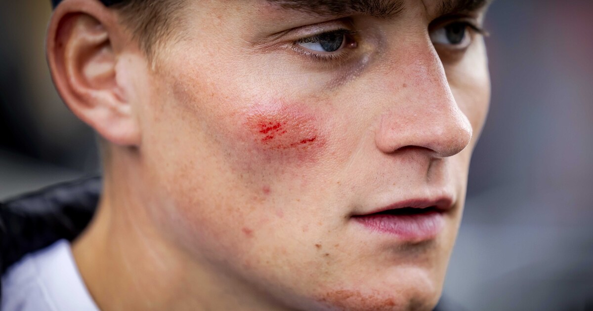 Als Mathieu van der Poel met zijn hoofd het grind raakt, verdwijnt één ...