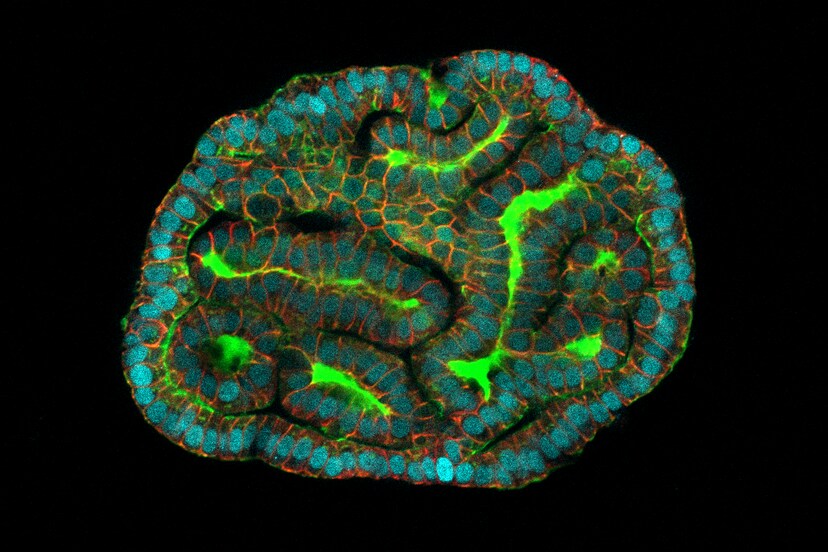 Met cellen uit vruchtwater kun je mini-organen kweken | Trouw