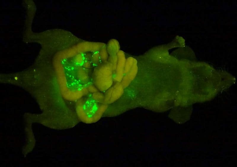 Spray toont ook kleinste restjes kanker | Trouw