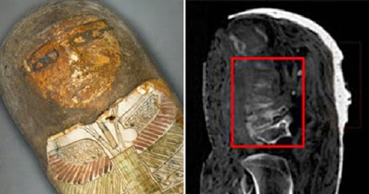 'Twee nepmummies in Vaticaanse Musea' | Trouw